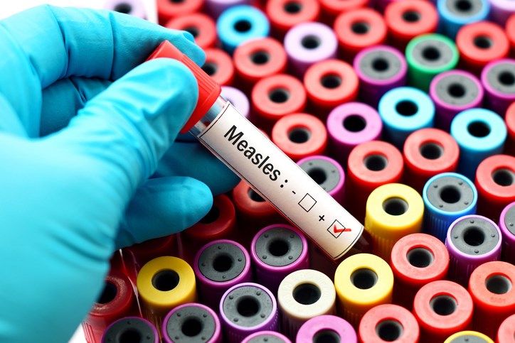 First Ohio measles case of 2025 reported in Ashtabula County - WFMJ.com