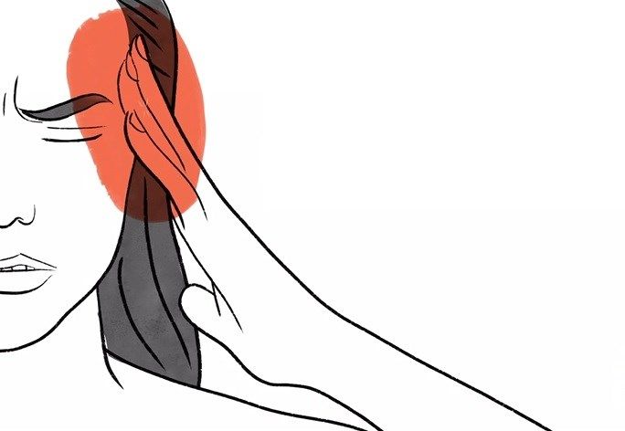 Botox Clinic at Warren hospital treats chronic migraines and focal ...